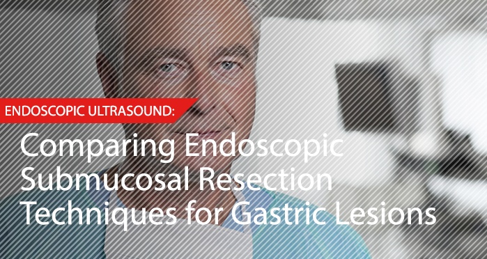Comparing Endoscopic Submucosal Resection Techniques for Small Gastric ...