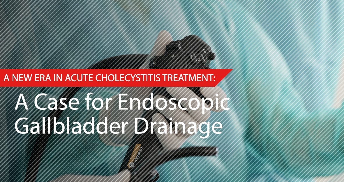 A New Era in Acute Cholecystitis Treatment: A Case for Endoscopic ...
