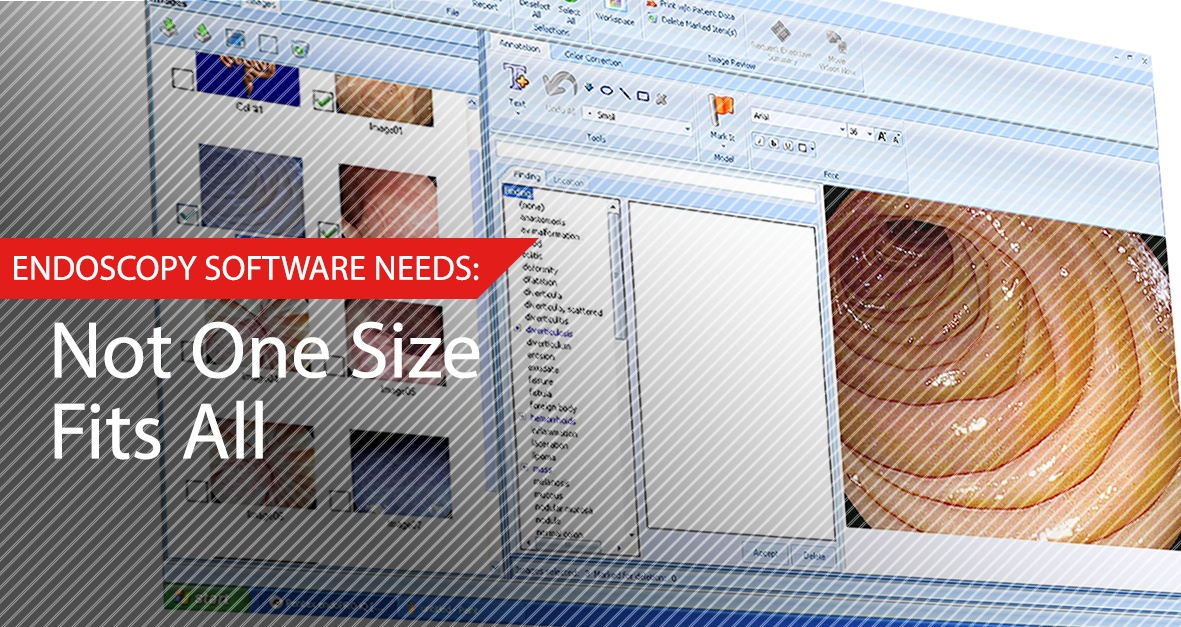 ENDOSCOPY SOFTWARE NEEDS—NOT ONE SIZE FITS ALL